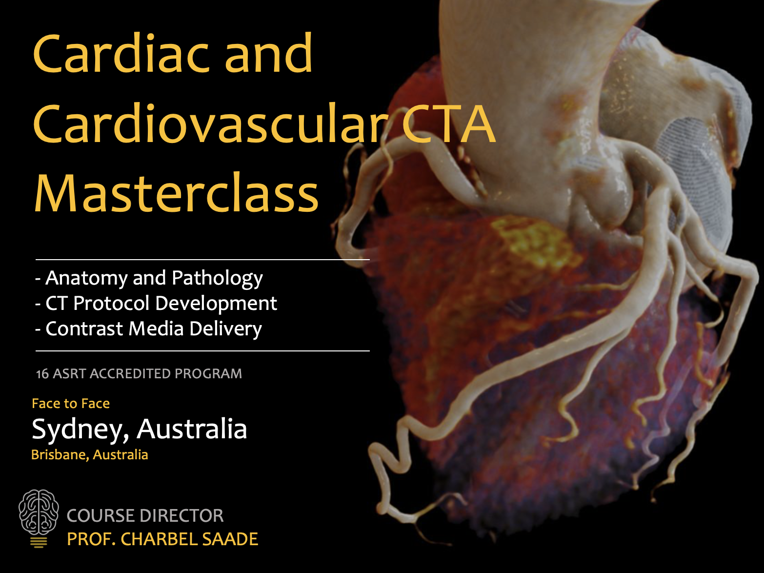About US| MDCT.com.au - Multi Detector Computed Tomography