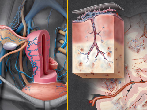 Home| MDCT.com.au - Multi Detector Computed Tomography
